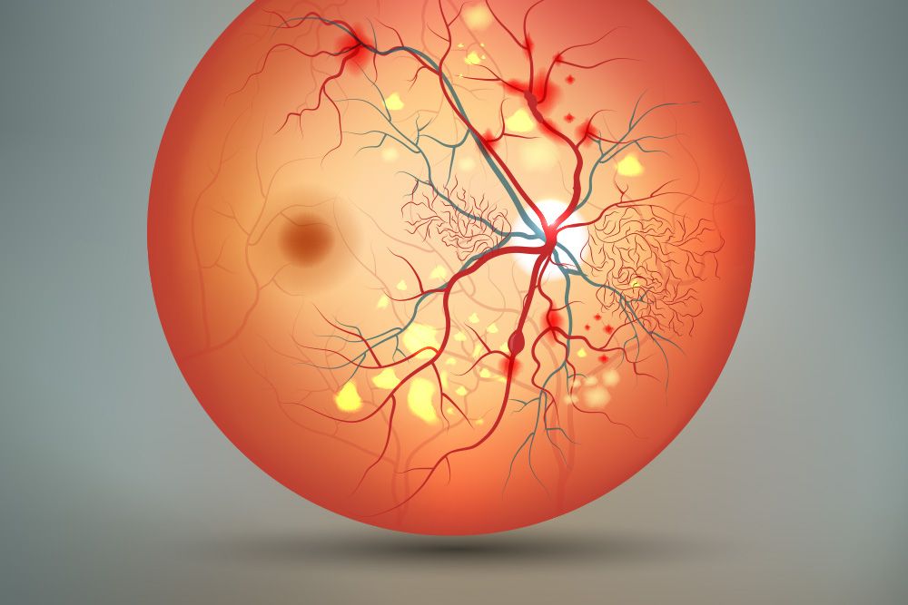 Risks Of Diabetic Retinopathy Monterey CA The Risks Of Diabetic R 